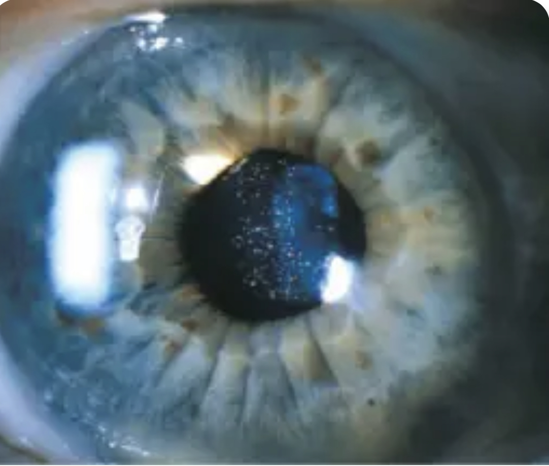 VSY – Accurate wave